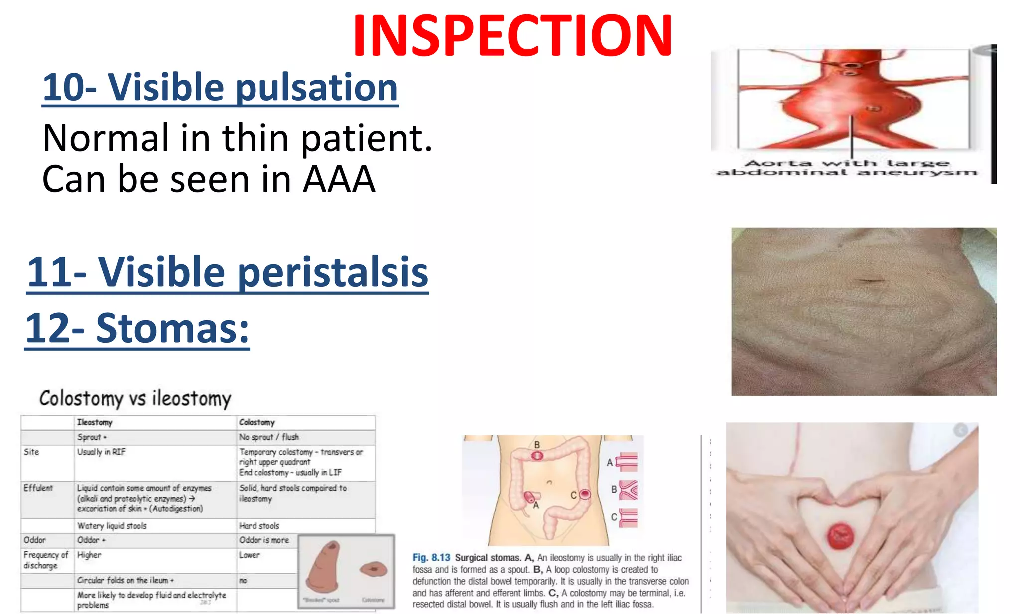 Abdominal examination | PPTX