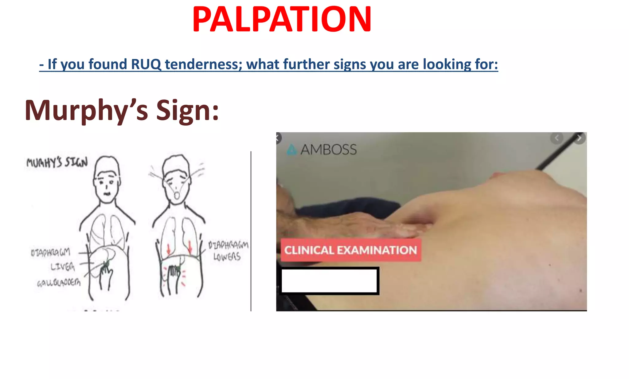 Abdominal examination | PPTX
