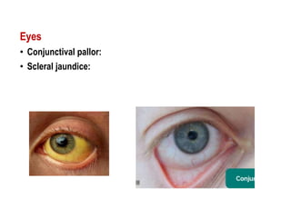 Abdominal examination | PPTX