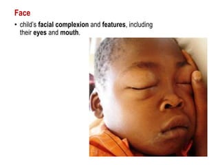 Abdominal examination | PPTX