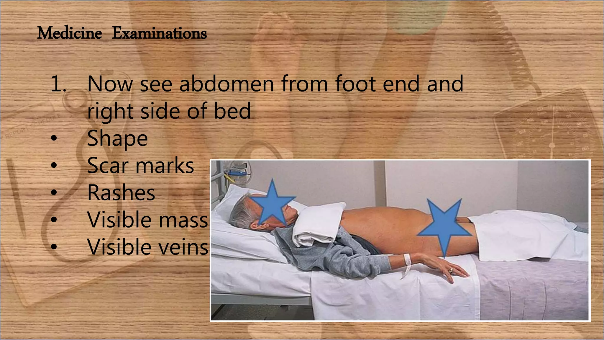Abdominal examination osce all steps | PPTX