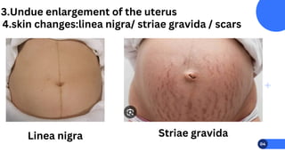 Abdominal Examination (1).pdfhjjnhhhbnnn | PDF