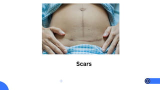 Abdominal Examination (1).pdfbjjnhnnbnnn | PPT