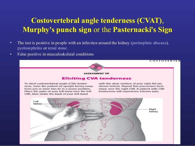 Abdominal examination byMuhamad Fathy (MD)