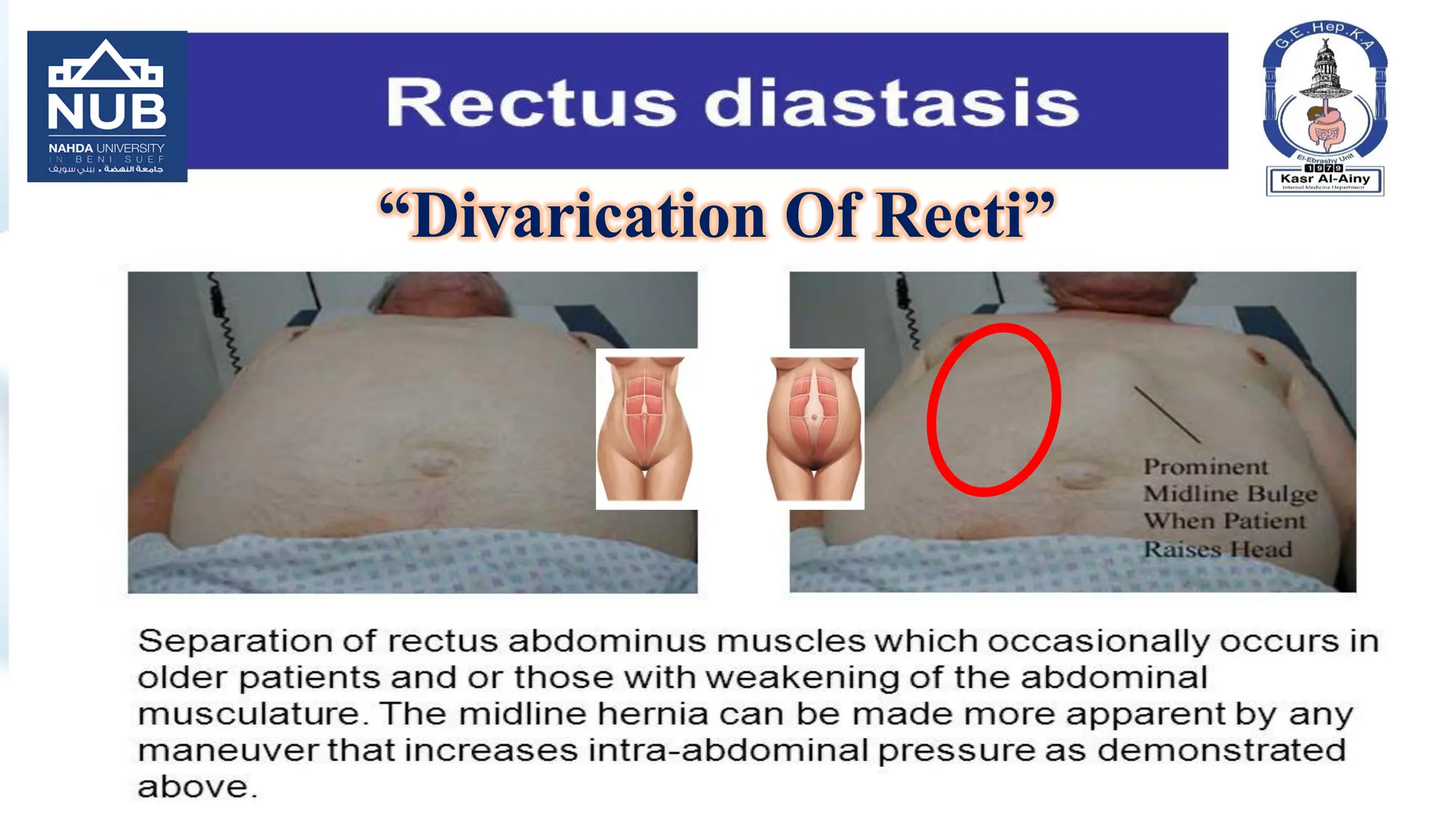 Abdominal Examination For Students (Chapter 1) | PDF