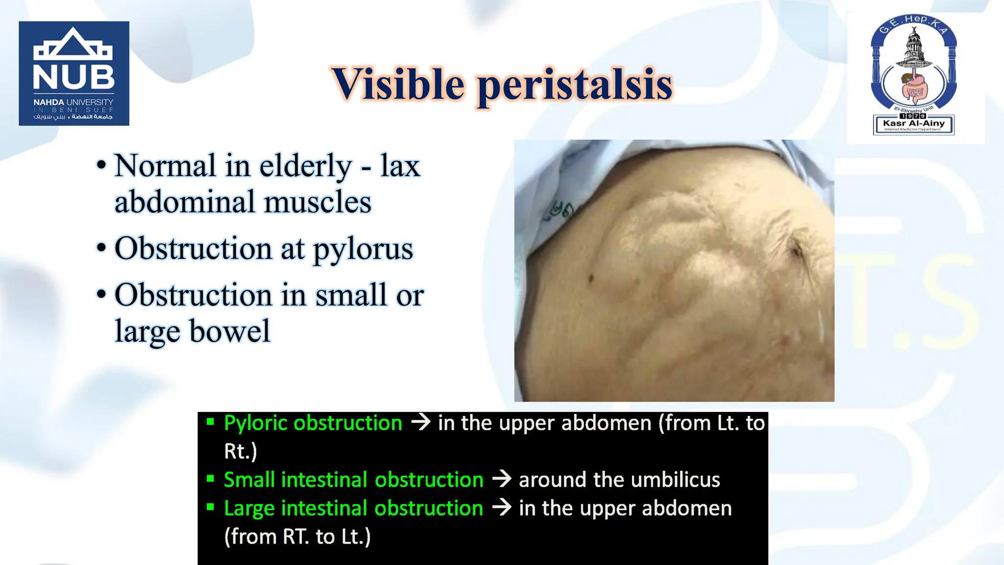 Abdominal Examination For Students (Chapter 1) | PDF