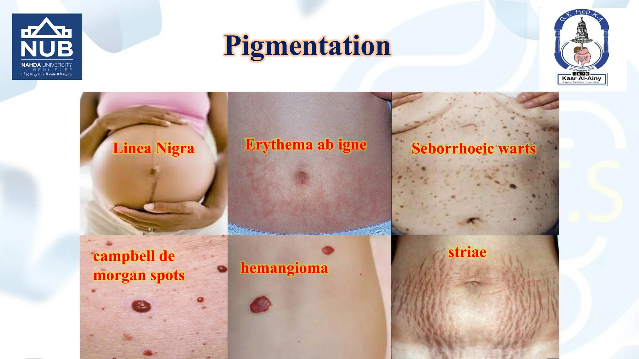 Abdominal Examination For Students (Chapter 1) | PDF