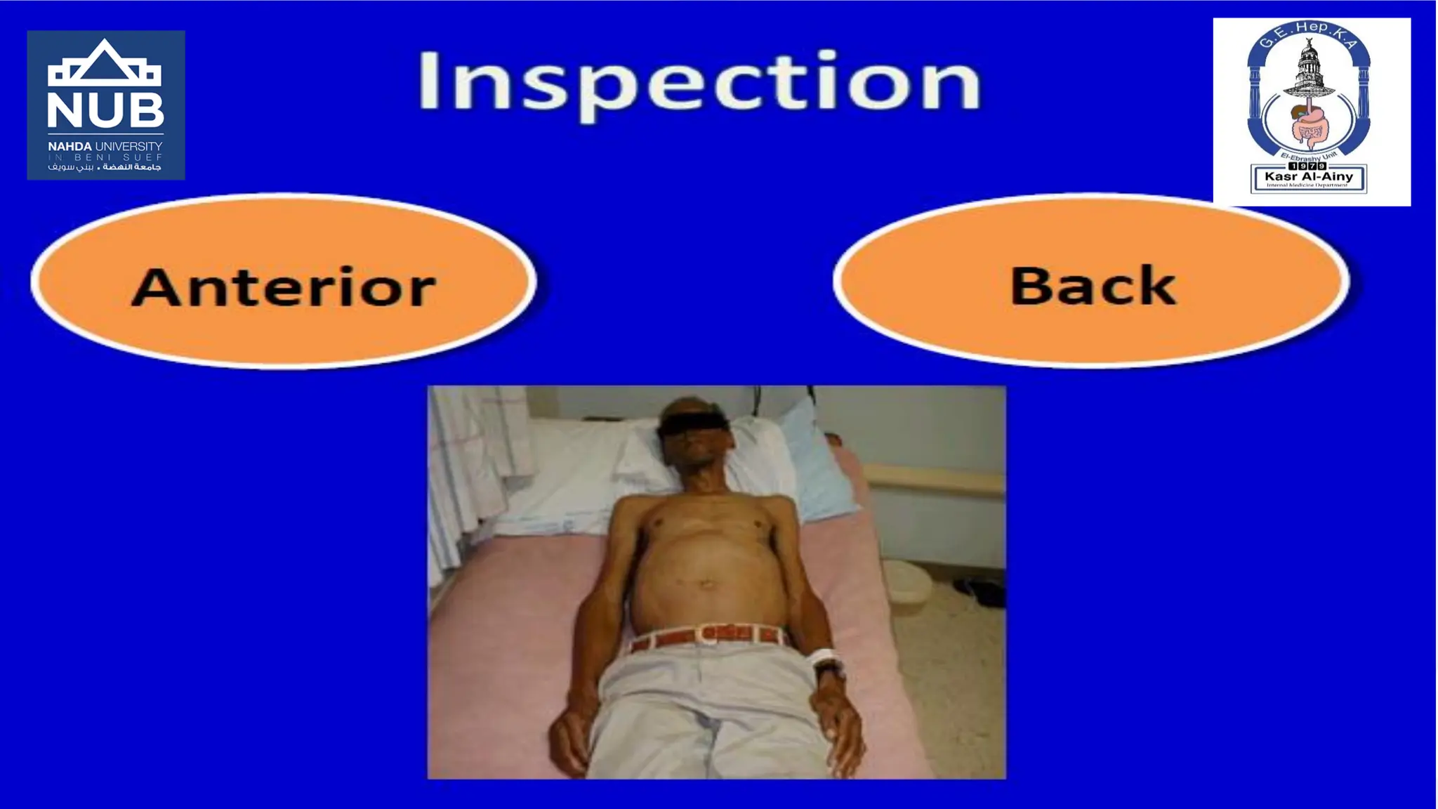 Abdominal Examination For Students (Chapter 1) | PDF