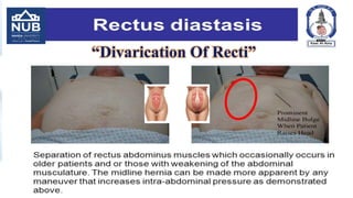 Abdominal Examination For Students (Chapter 1) | PDF