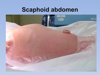 Abdominal Examination (Part 1)...ppt.pptx | Digestive Disorders ...