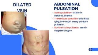 ABDOMINAL EXAMINATION Presentation[1].pptx