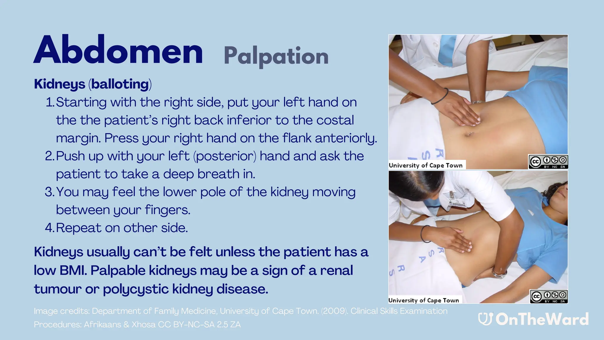 Abdominal Examination PowerPoint (OnTheWard.com)) | PDF