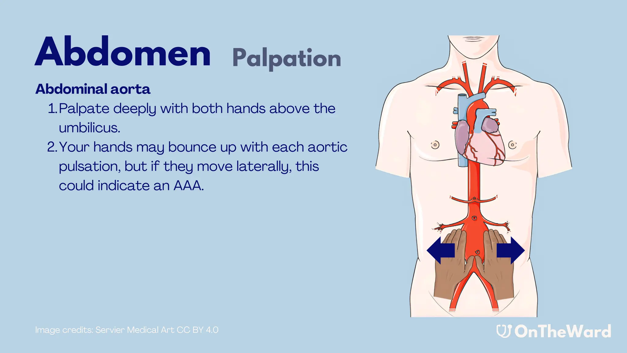 Abdominal Examination PowerPoint (OnTheWard.com)) | PDF