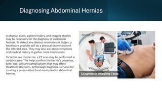 Abdominal Hernia - Symptoms & Treatment Guide.pdf