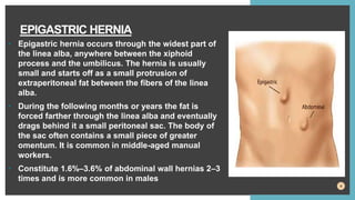 ABDOMINAL HERNIAS.pptx