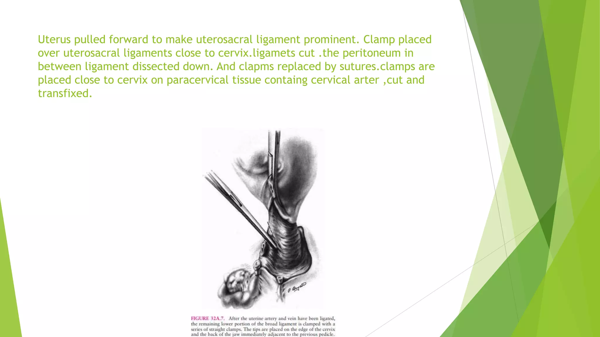Abdominal hysterectomy.pptx