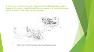 Abdominal hysterectomy.pptx
