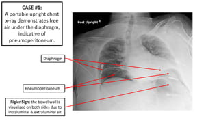 Abdominal Imaging Case Studies #27.pptx