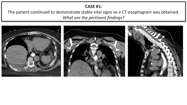 Abdominal Imaging Case Studies #27.pptx