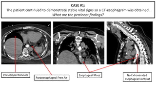 Abdominal Imaging Case Studies #27.pptx