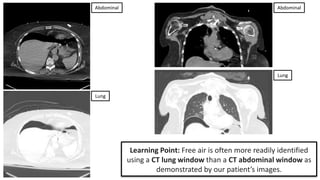 Abdominal Imaging Case Studies #27.pptx