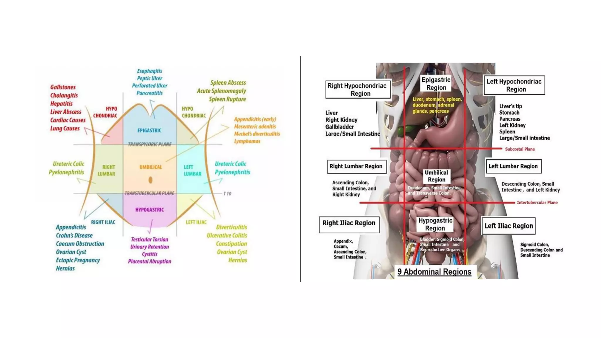 Abdominal Incision.pdf