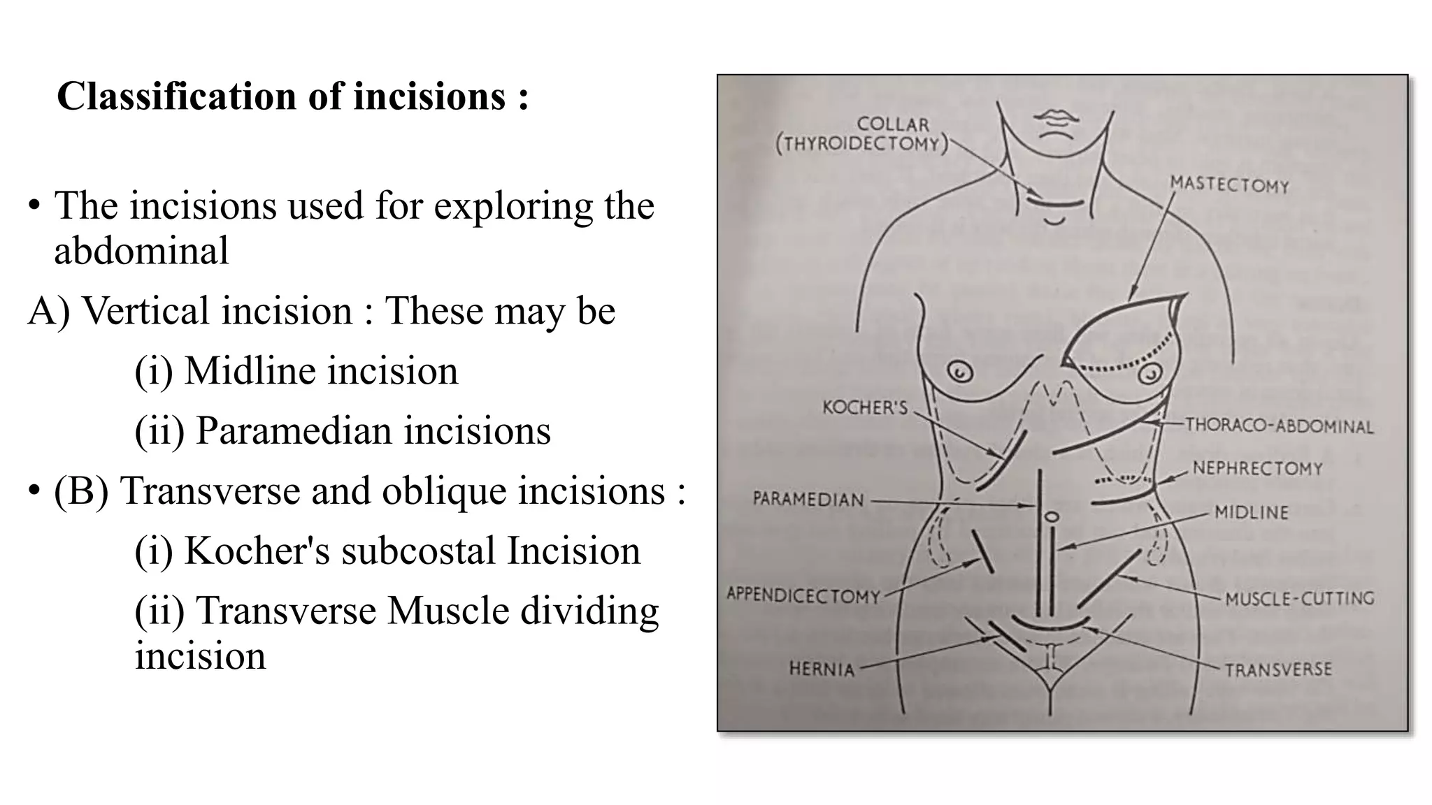 abdominal incision.pptx