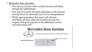 GENERAL ABDOMINAL INCISION FOR PHYSIOTHERAPY | PPTX
