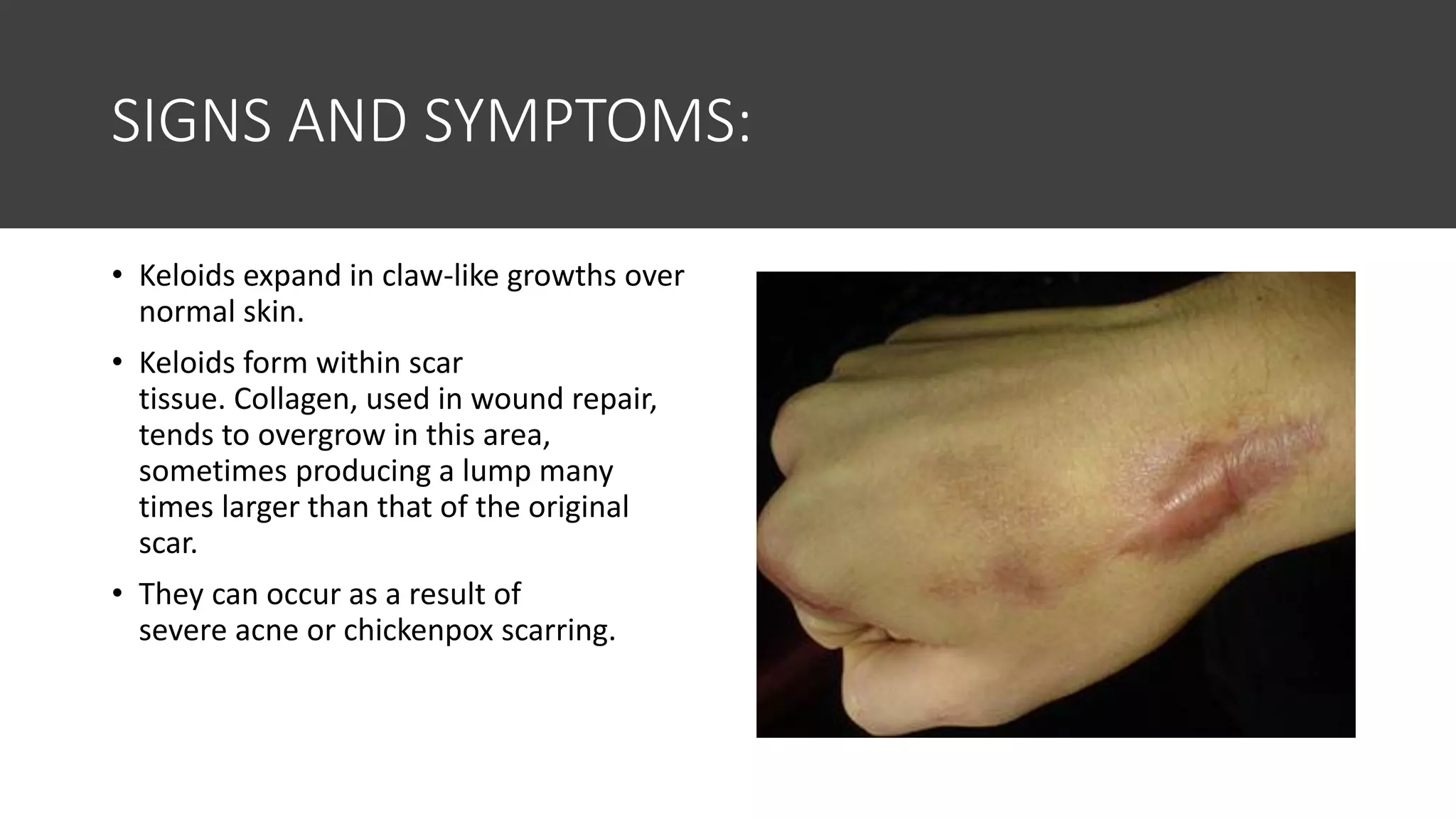 SURGICAL INCISIONS ON ABDOMINAL WALL | PDF