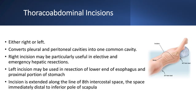 SURGICAL INCISIONS ON ABDOMINAL WALL | PDF