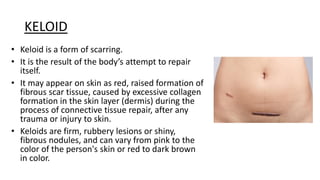 SURGICAL INCISIONS ON ABDOMINAL WALL | PDF