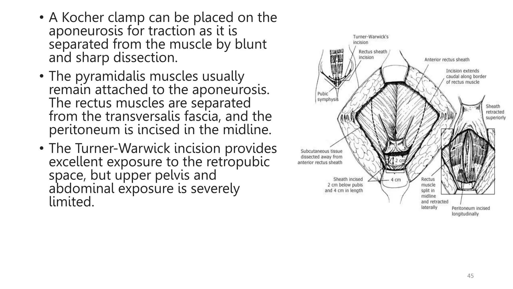 Abdominal Incision Barasima G_121502.pptx