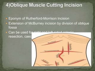 Abdominal incisions | PPTX