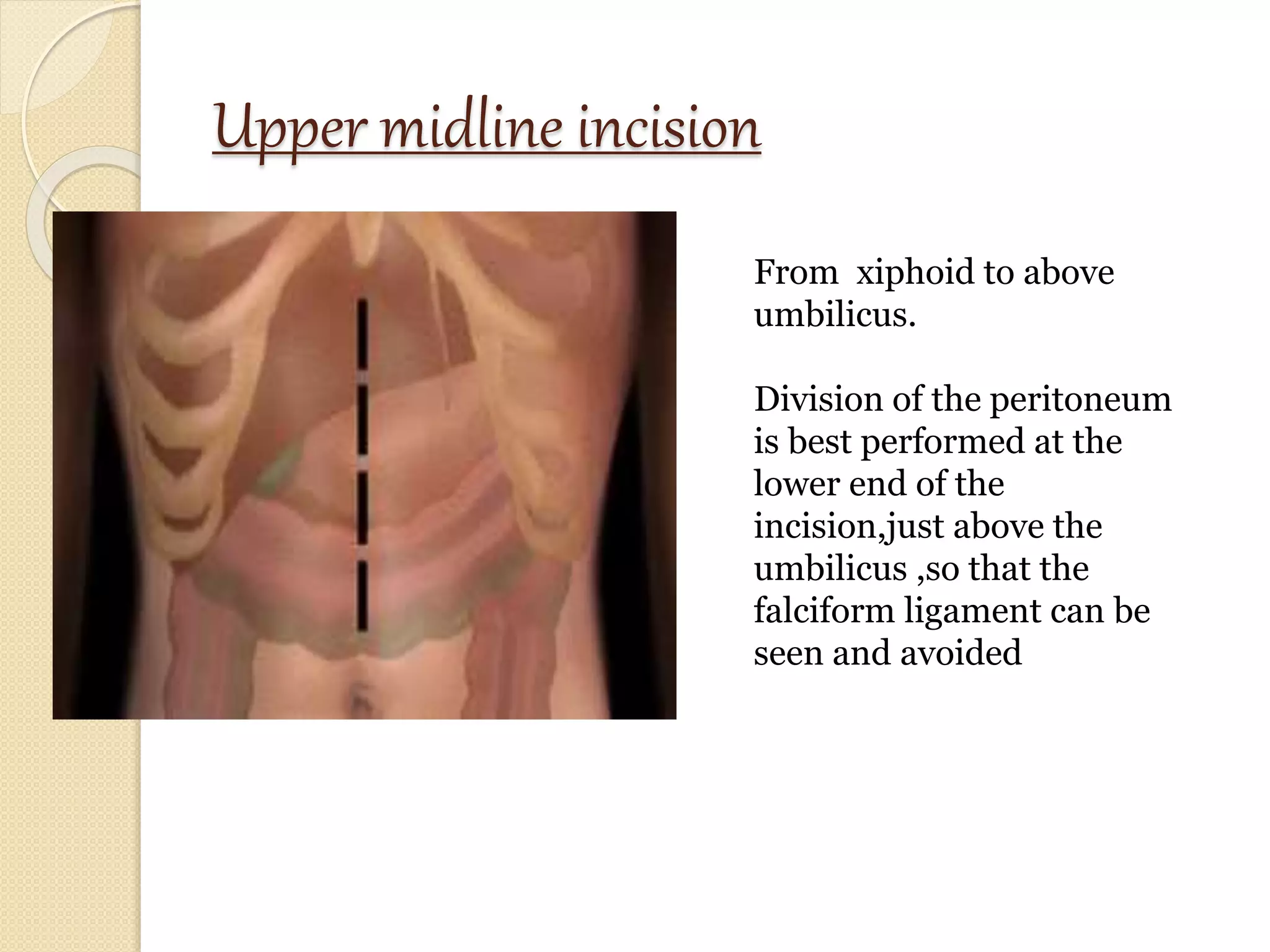 Abdominal incisions | PPTX