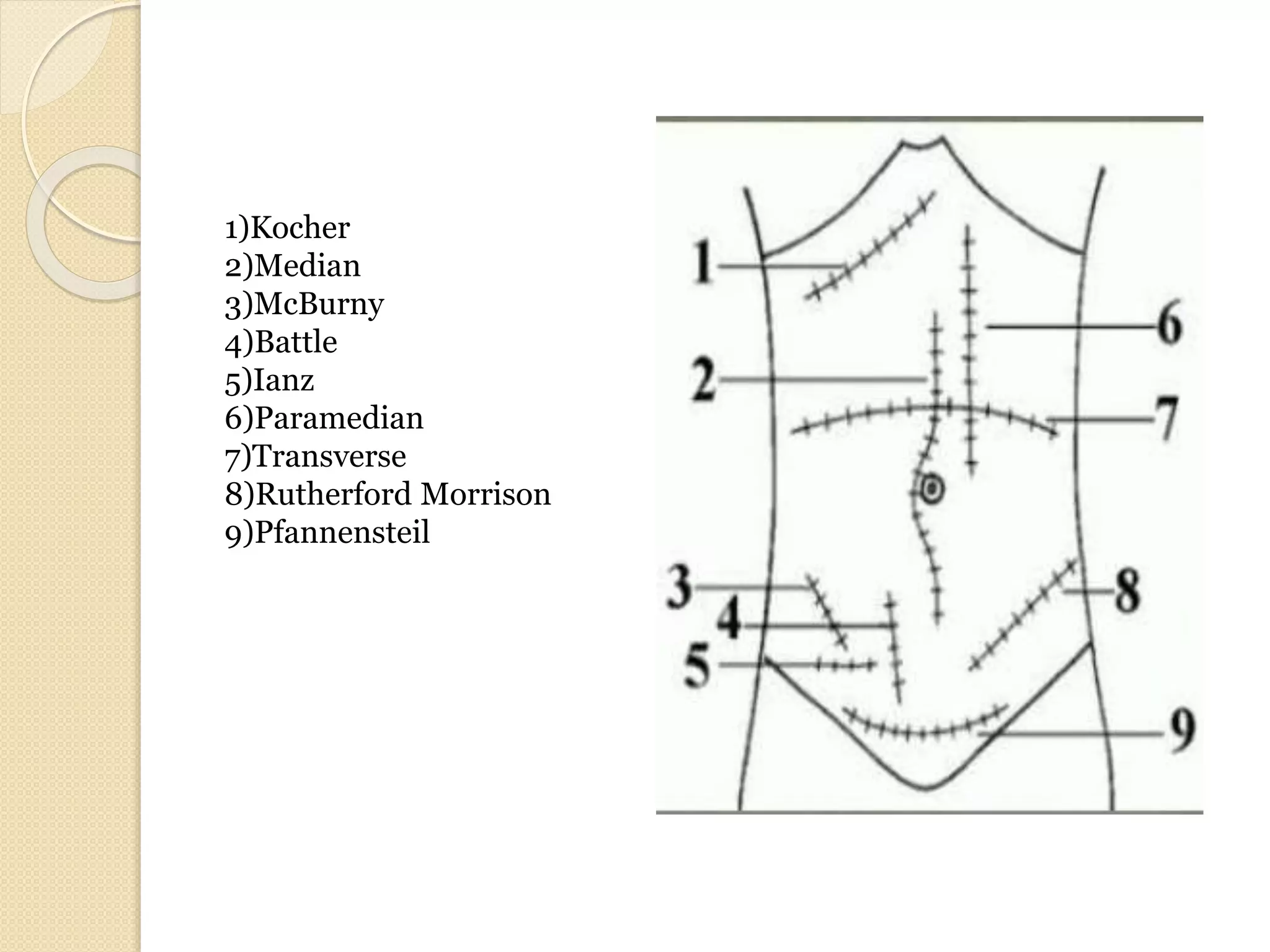 Abdominal incisions | PPTX