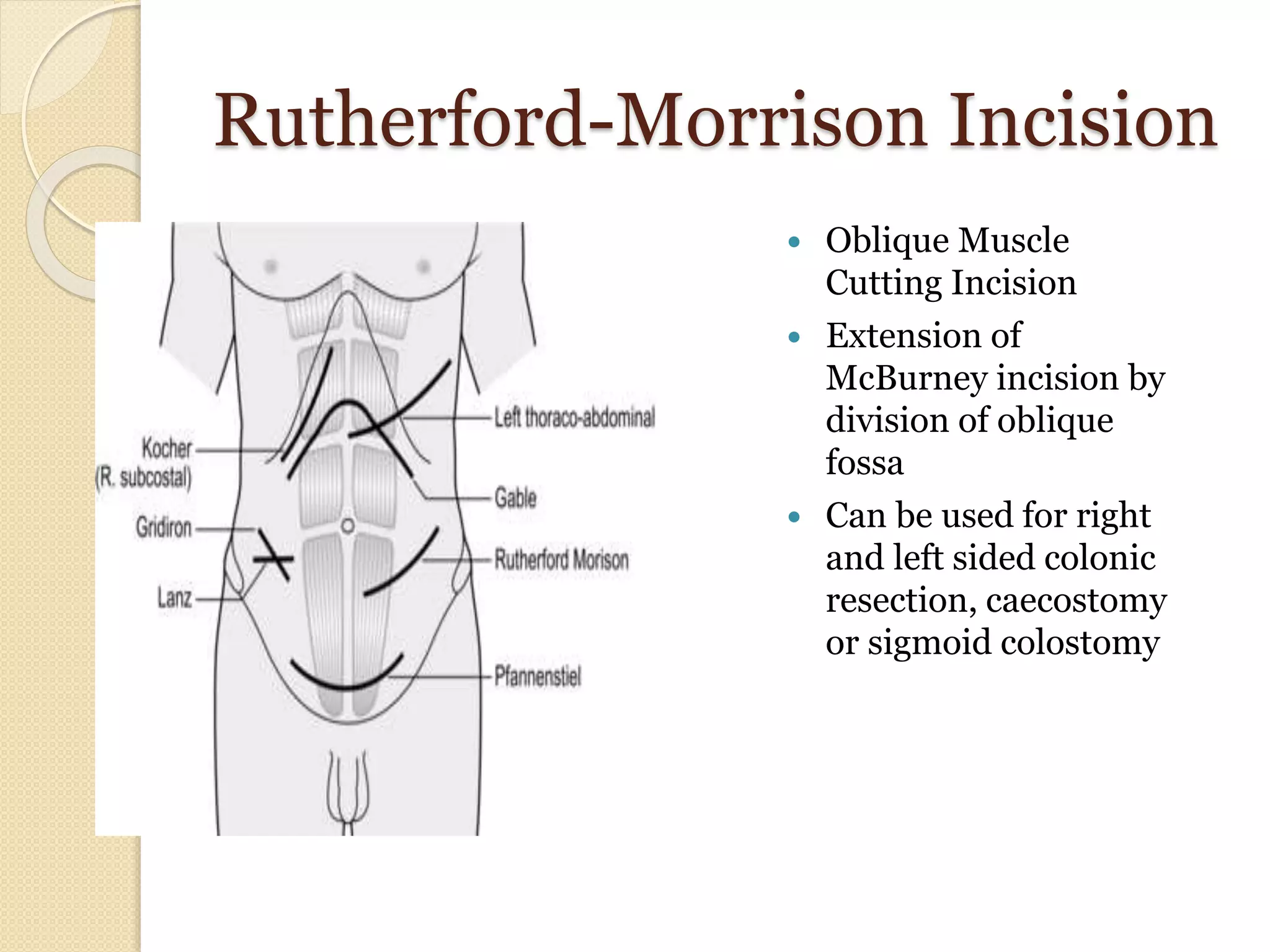 Abdominal incisions | PPTX
