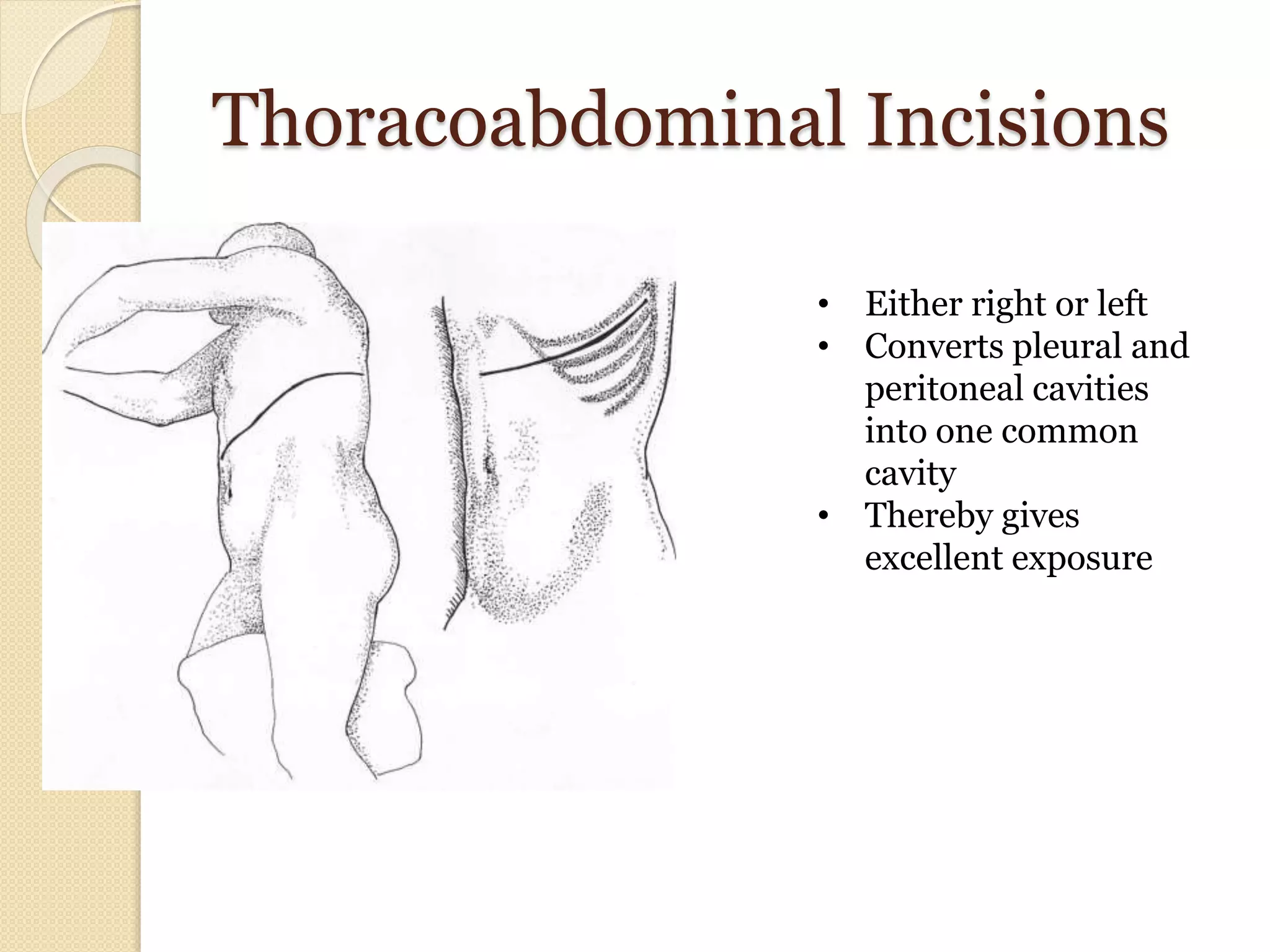 Abdominal incisions | PPTX