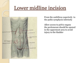 Abdominal incisions | PPTX