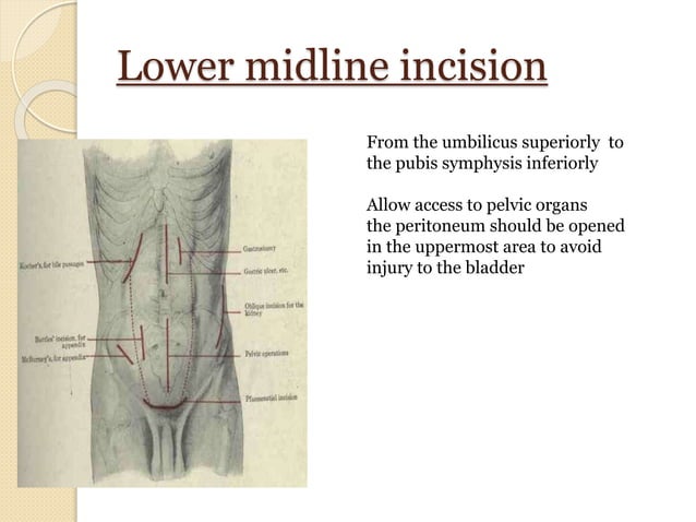 Abdominal incisions | PPTX | Pregnancy | Reproductive Health