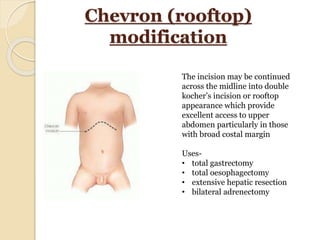 Abdominal incisions | PPTX