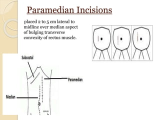 Abdominal incisions | PPT