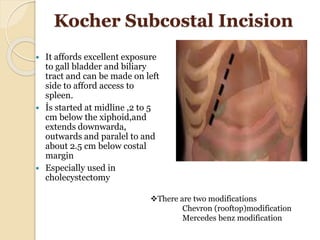 Left Subcostal Incision