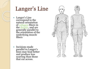 Abdominal incisions | PPT