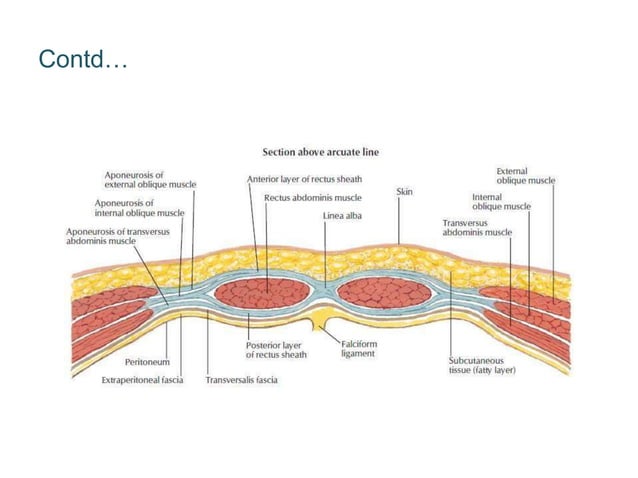 abdominalincisions-181217152303.pptx