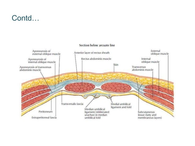 abdominalincisions-181217152303.pptx