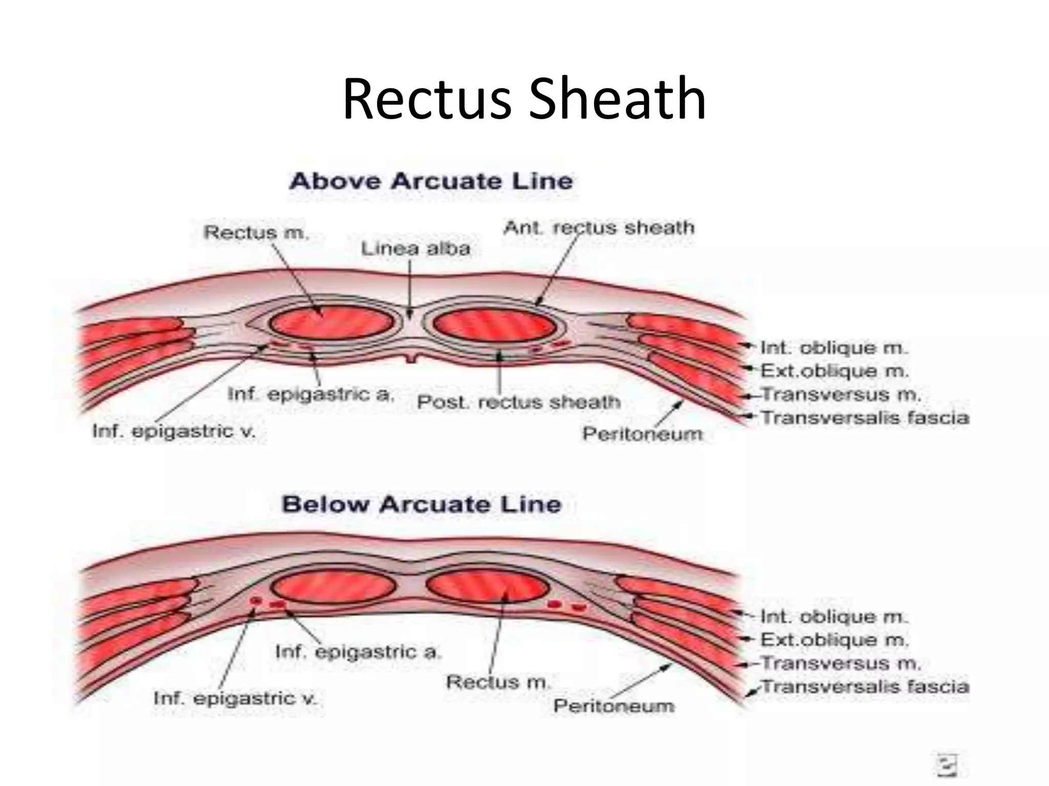Abdominal incisions | PPTX