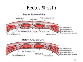 Abdominal incisions | PPTX