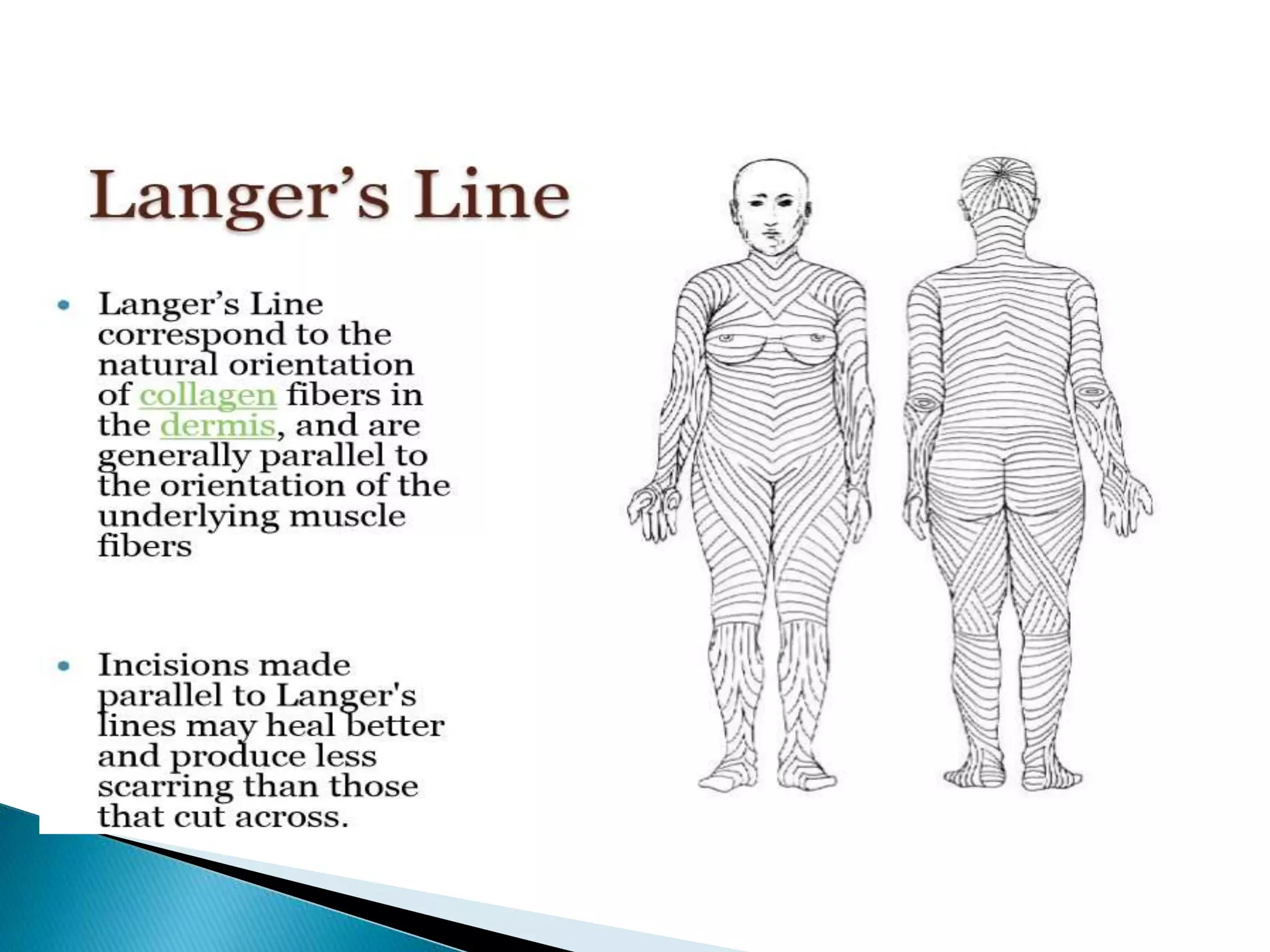 Abdominal incisions | PPTX