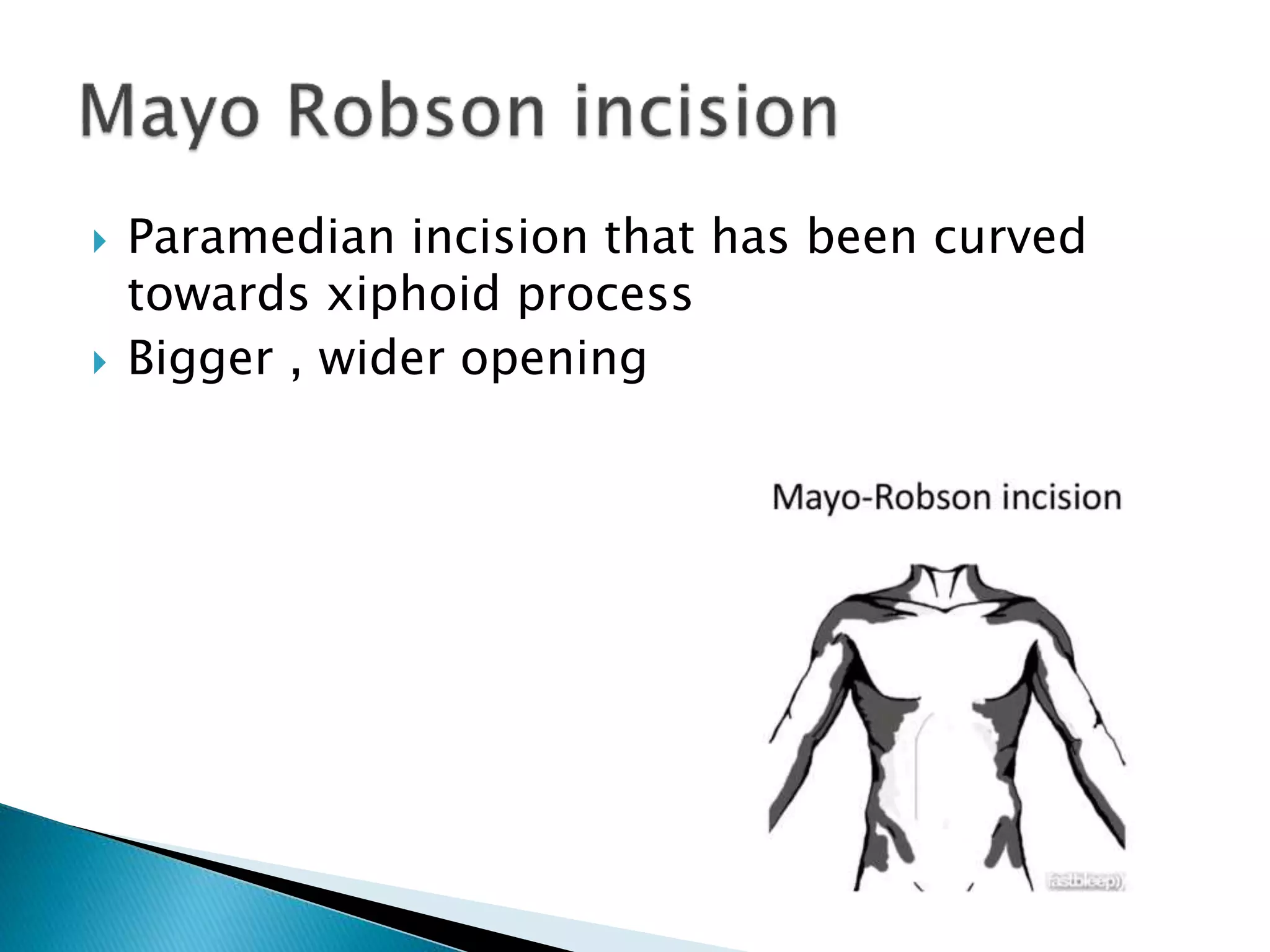 Abdominal incisions | PPTX
