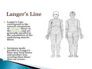 Abdominal incisions | PPTX